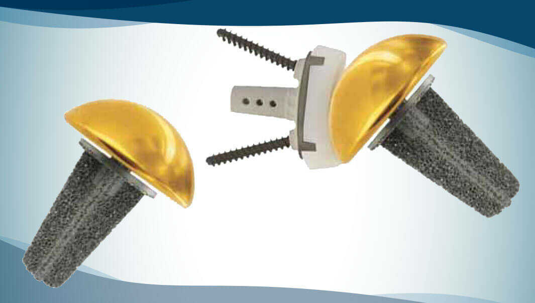 Implantcast - Os melhores produtos para Ombro, Joelho, Quadril