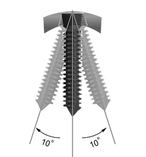 CarboFix - Distal Femur Plates - Ortospine